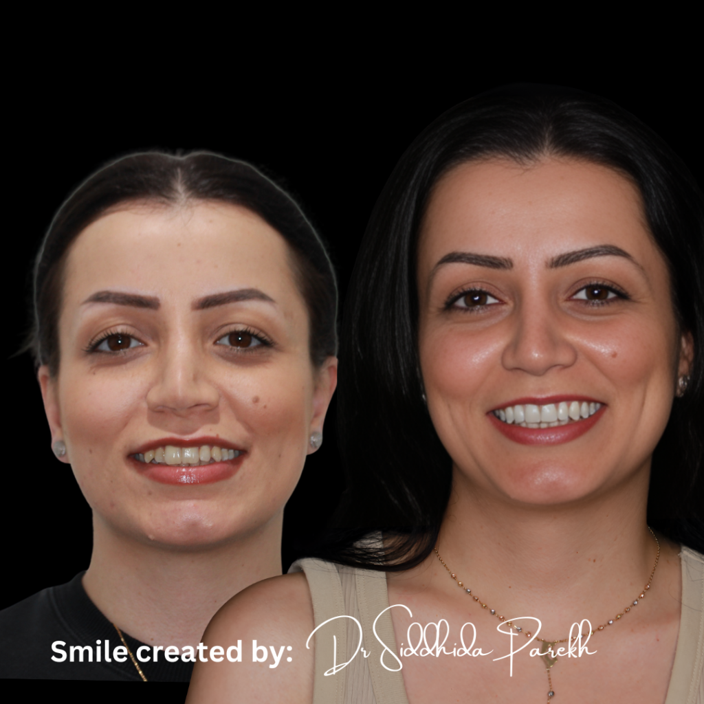 Perfect Dental Care – Perfect Dental Care